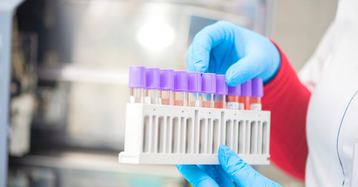 Immune thrombocytopenia (ITP) diagnosis and testing | Bleeding ...
