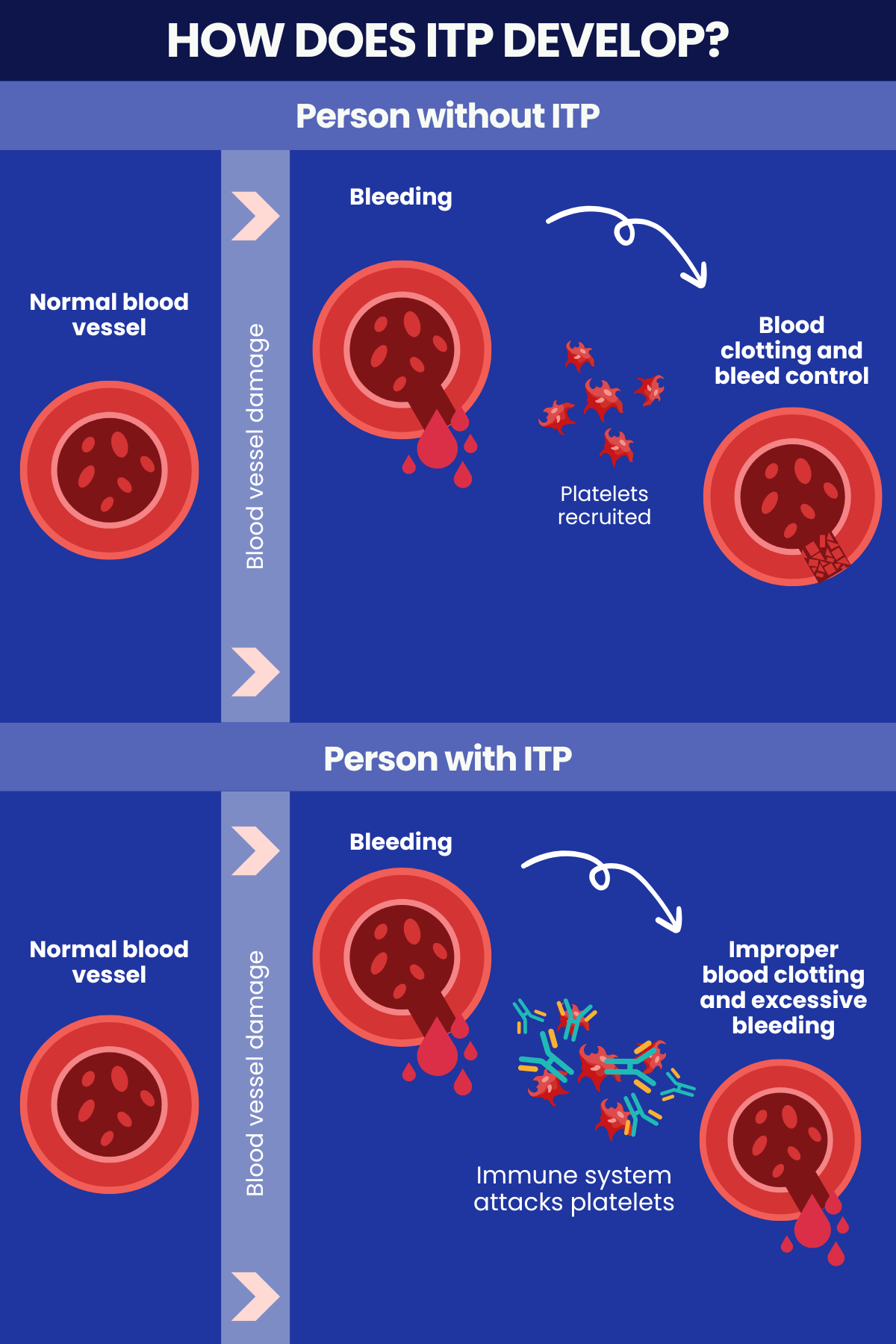 Immune thrombocytopenia: Everything you need to know | Bleeding ...