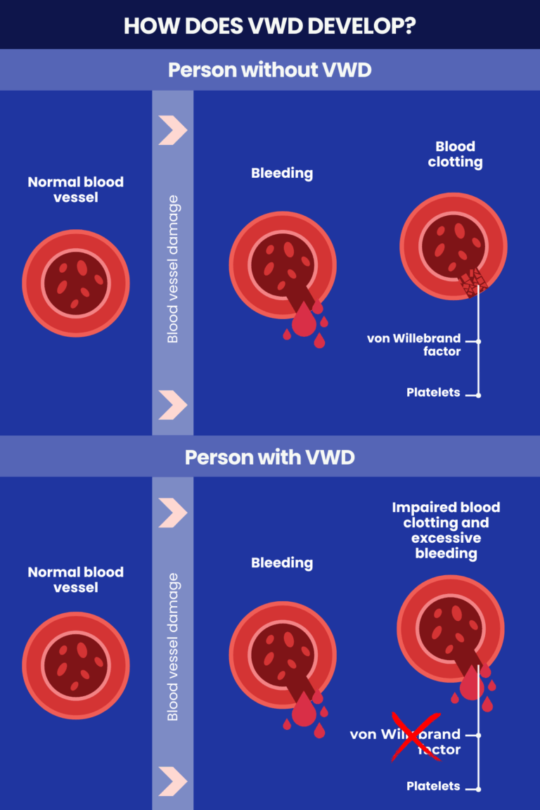 Von Willebrand disease | Bleeding Disorders News